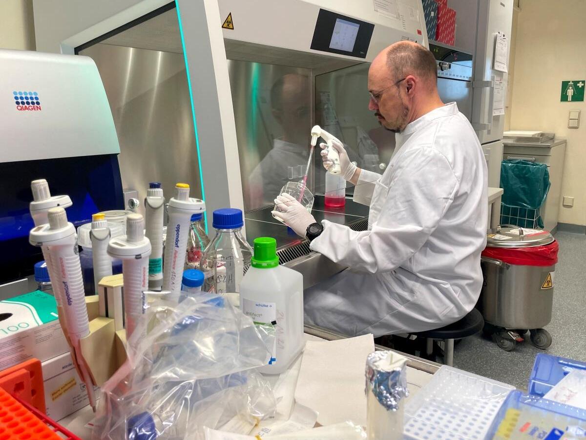 CDC Mỹ: Virus đậu mùa khỉ có thể bám trên các vật dụng trong nhà